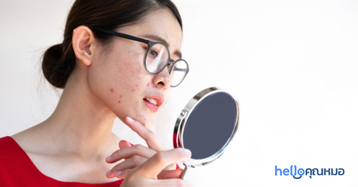 7 วิธีดูแลผิวหน้า แบบธรรมชาติ ทำได้อย่างไรบ้าง - Hello Khunmor