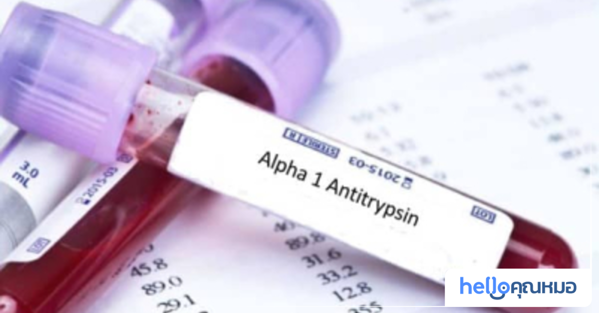 ทดสอบอัลฟ่าวัน แอนตี้ทริปซิน (Alpha-1 Antitrypsin Test)